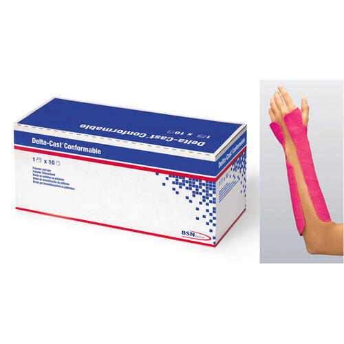 BSN Delta-Cast Conformable PINK oder BLAU kaufen